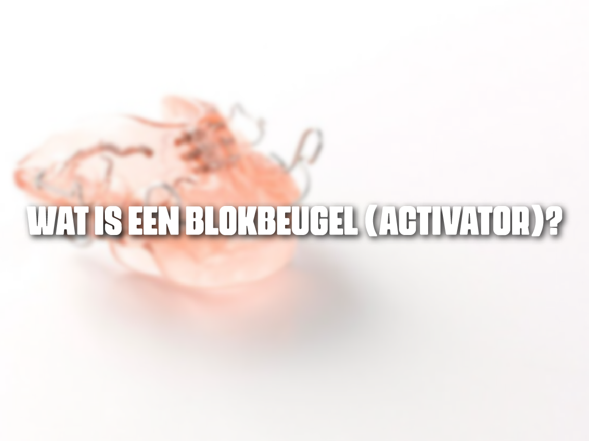 Wat is een blokbeugel (activatorl)? | Ortho Billet